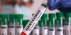 Hantavirus, allarme contenuto in Sicilia. Un caso sospetto con ricovero ...
